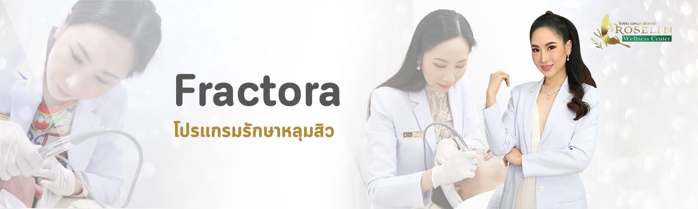 FRACTORA คืออะไร? รวมสิ่งต้องรู้เลเซอร์รักษาหลุมสิว