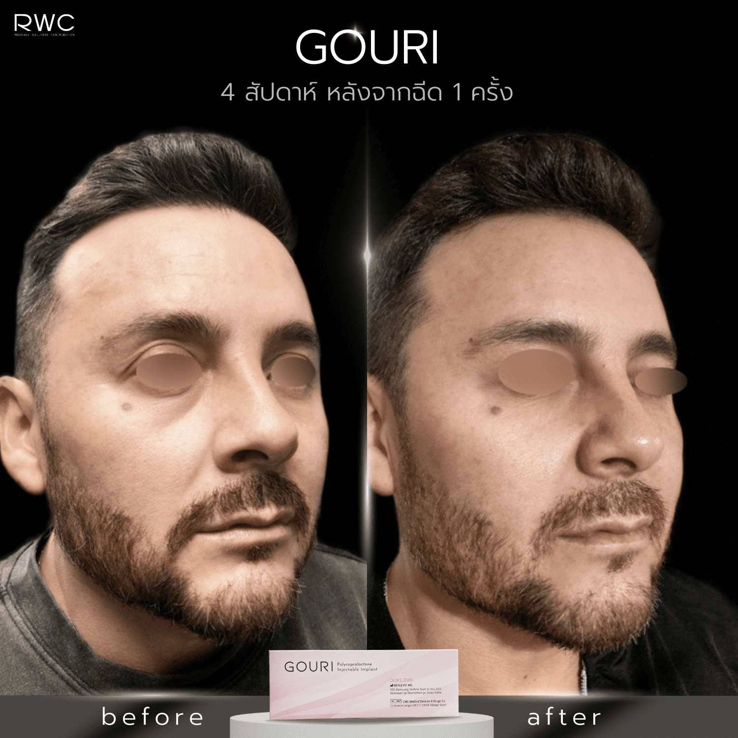 Gouri คอลลาเจน ฟื้นฟูผิว ให้กระจ่างใส สุขภาพดี